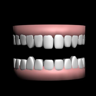 free teeth 3d model