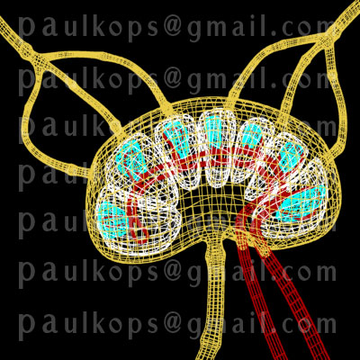 3d lymp node lymphnode model