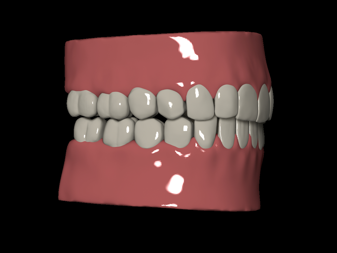 3D denture zbrush - TurboSquid 1160534