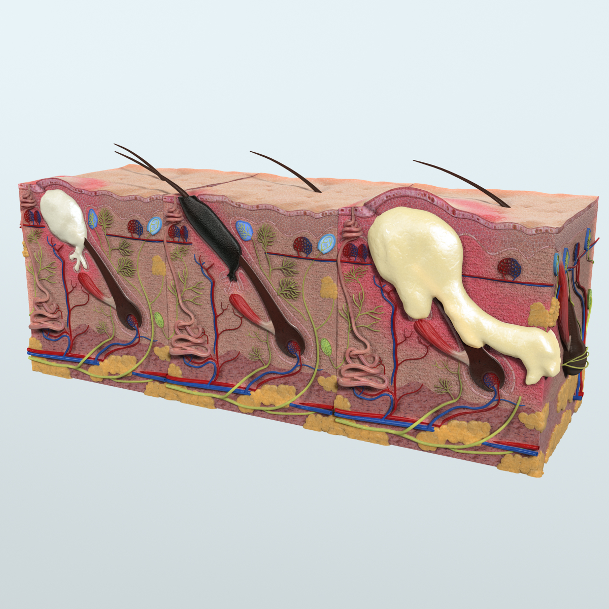 Realistic skin acne anatomy 3D model - TurboSquid 1164399