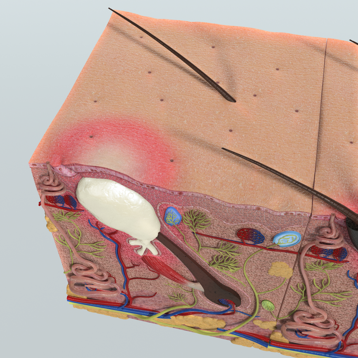 Realistic skin acne anatomy 3D model - TurboSquid 1164399