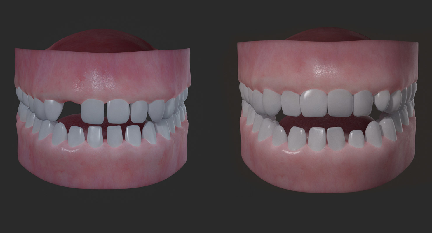 modelo 3d Niños realistas dientes y encías - TurboSquid 1173908