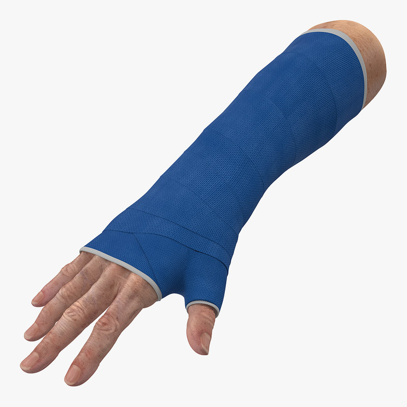Fiberglass cast wrist model - TurboSquid 1230113