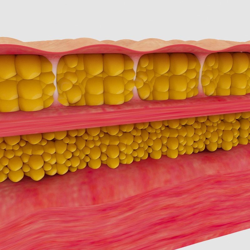Cellulite 3D model - TurboSquid 1281972