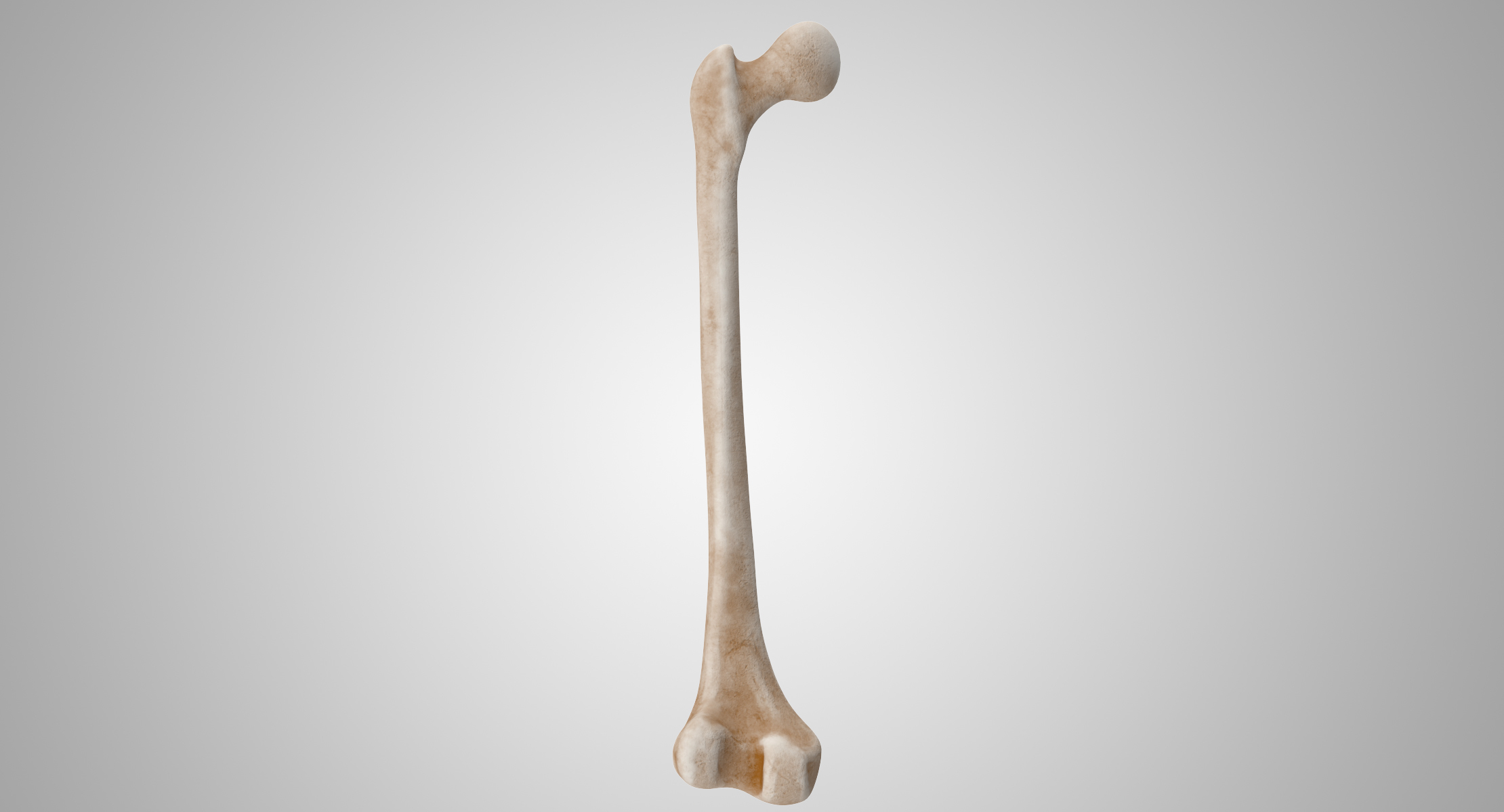 3D thigh bone femur model - TurboSquid 1296590