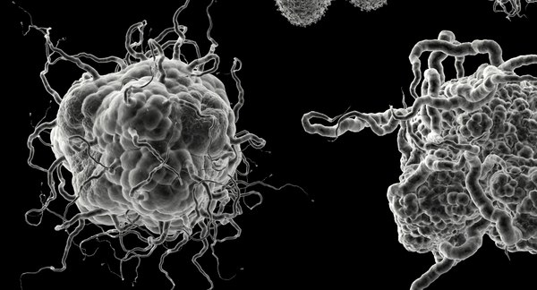 Cancer cell 3D - TurboSquid 1309926