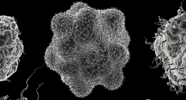 Cancer cell 3D - TurboSquid 1309926