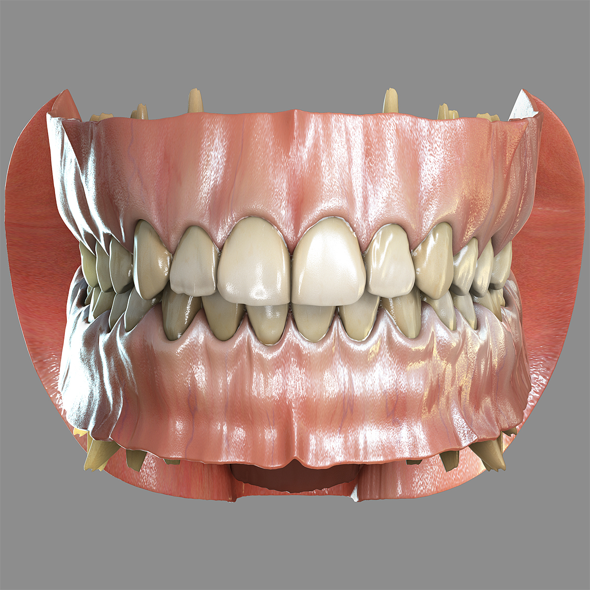 3d model orthodontics mouth teeth