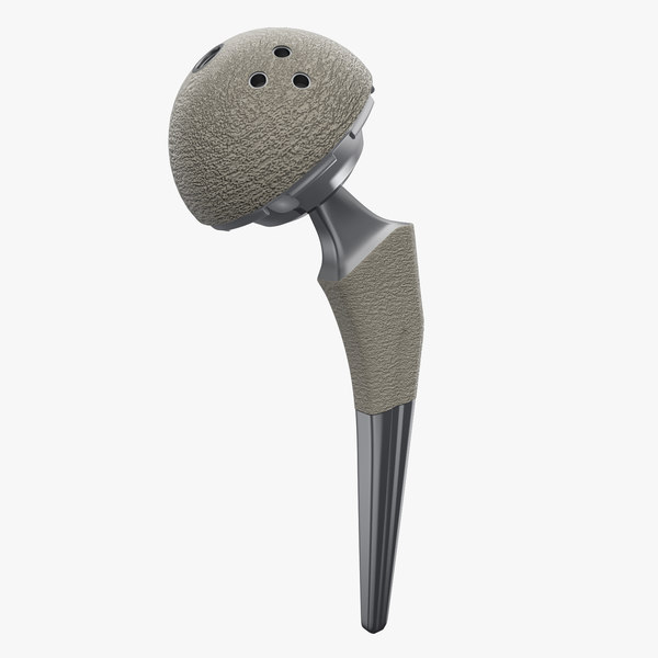 max femoral prosthesis