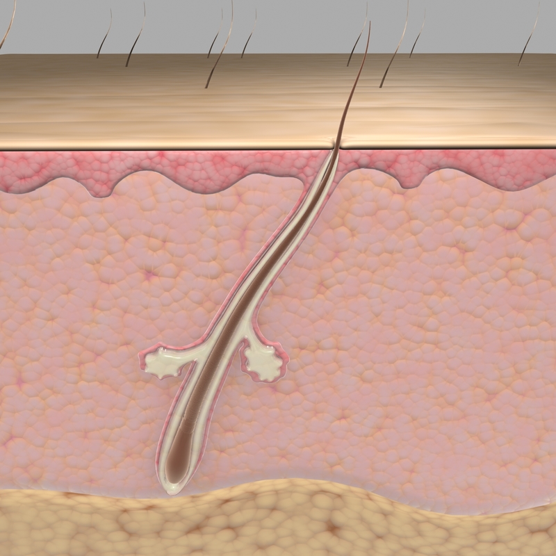 3d acne hair follicle animation
