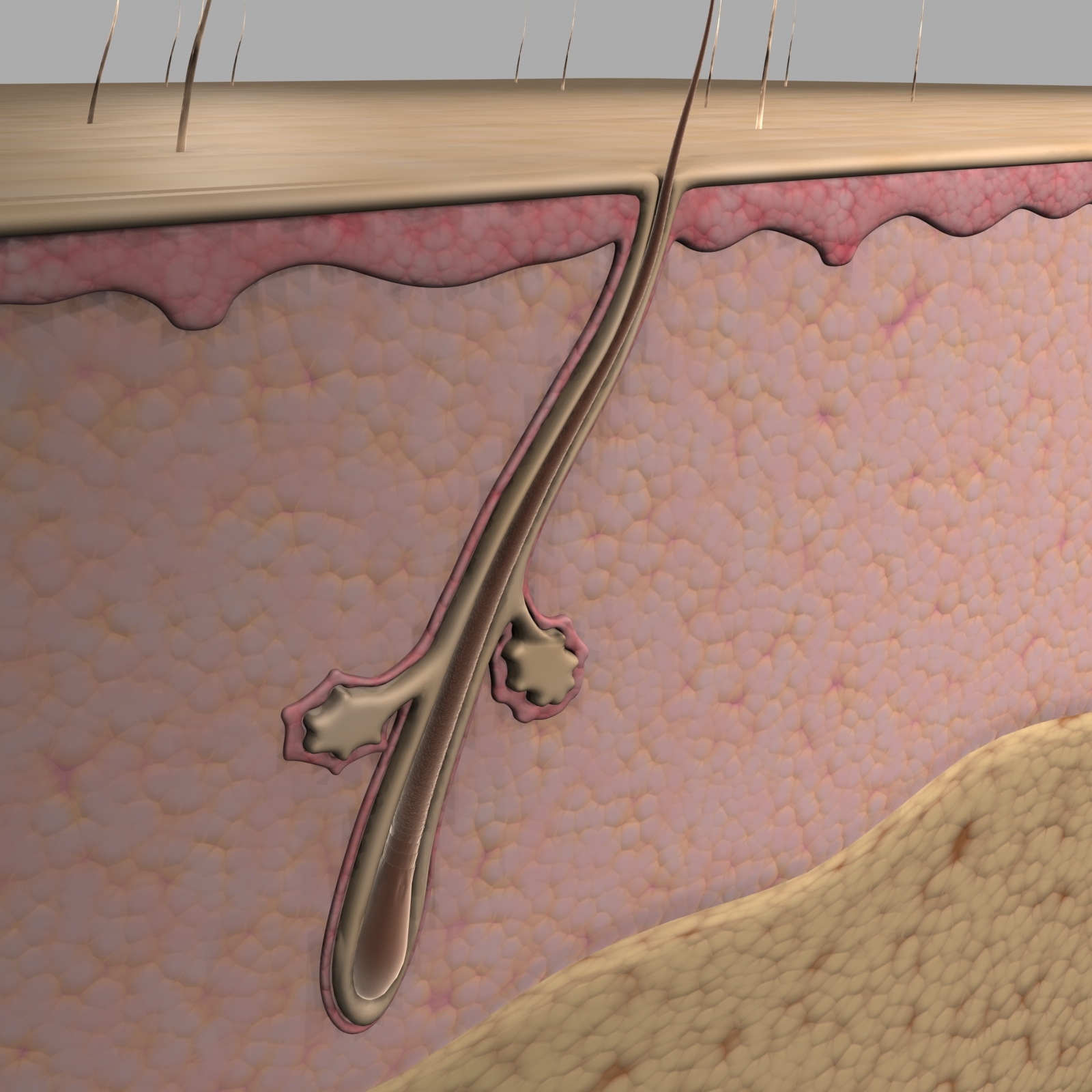 3d acne hair follicle animation