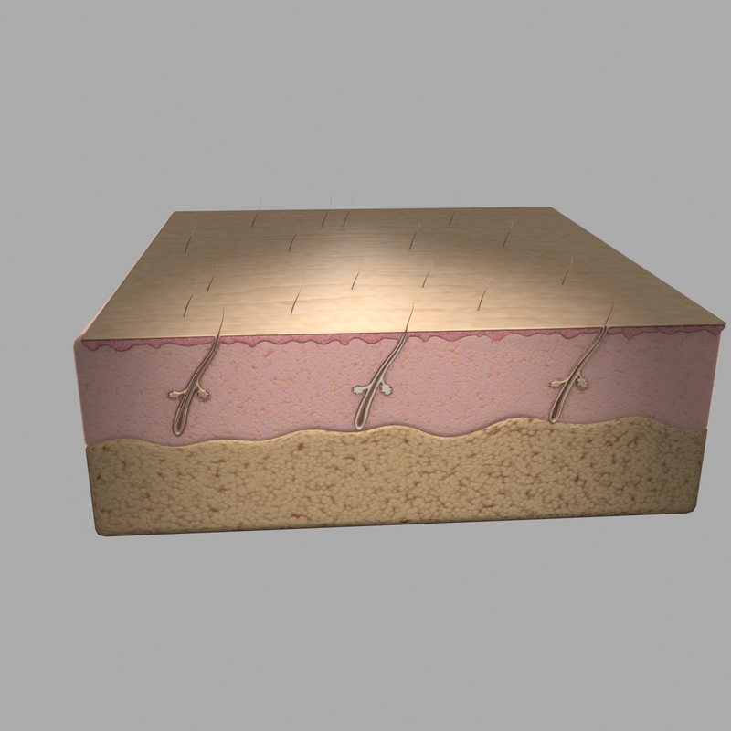 3d acne hair follicle animation