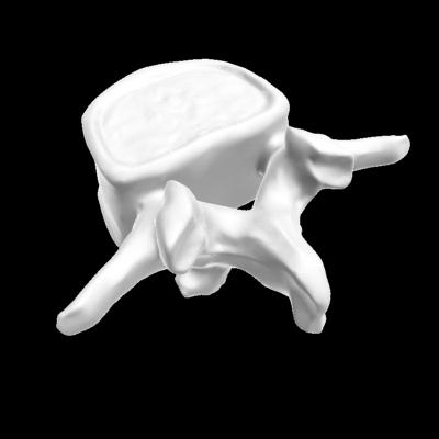 3d vertebrae model