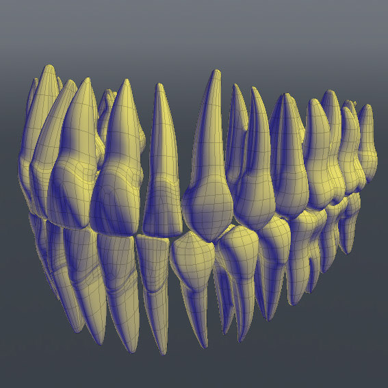 dental 3d model