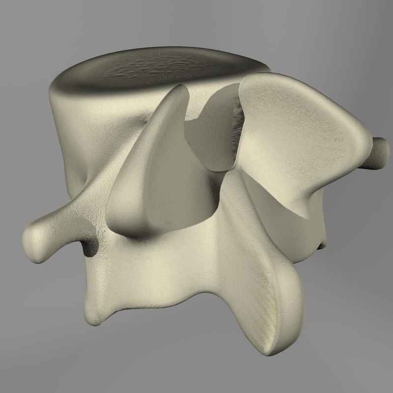 3d lumbar vertebrae model