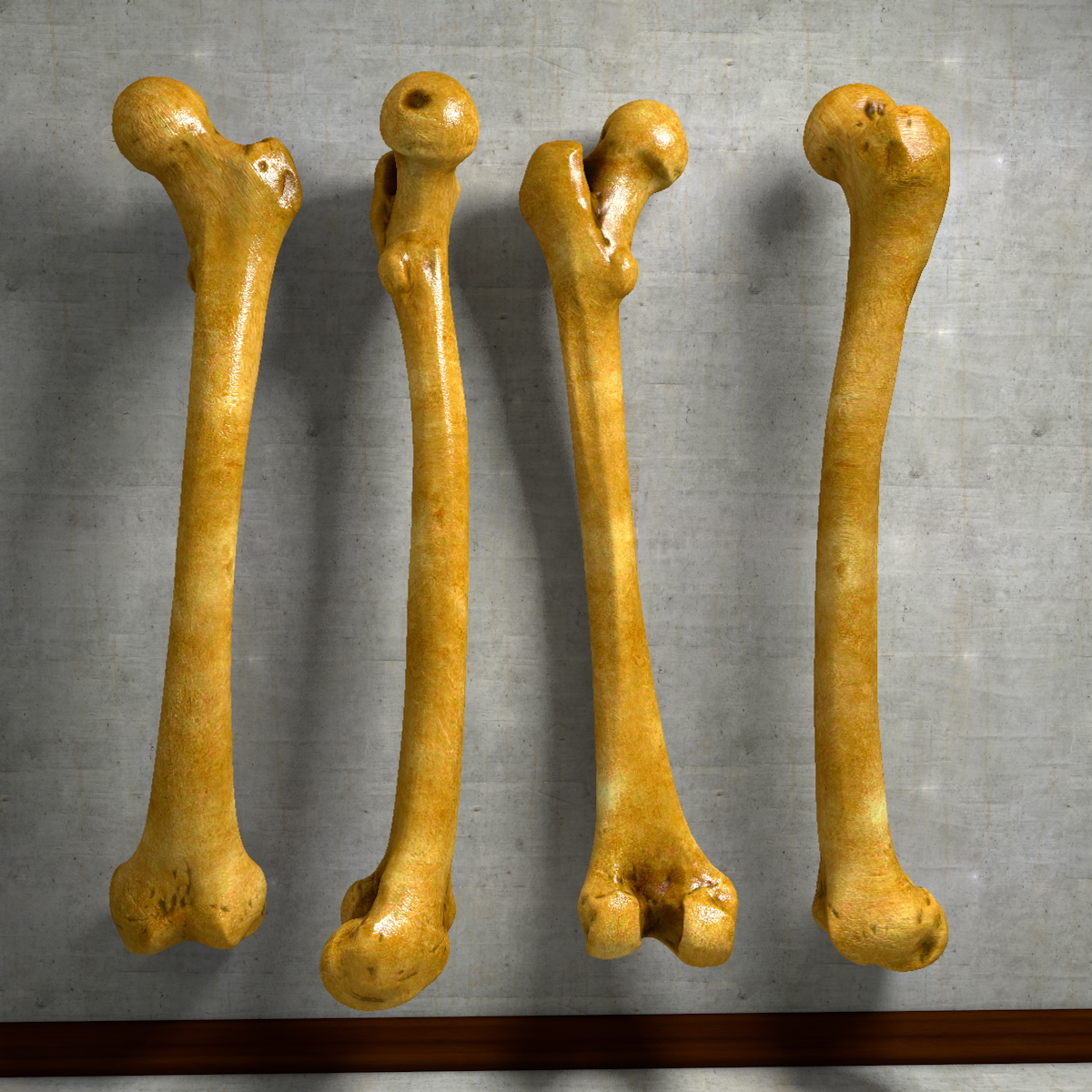 Human Thigh Bone Femur C4d