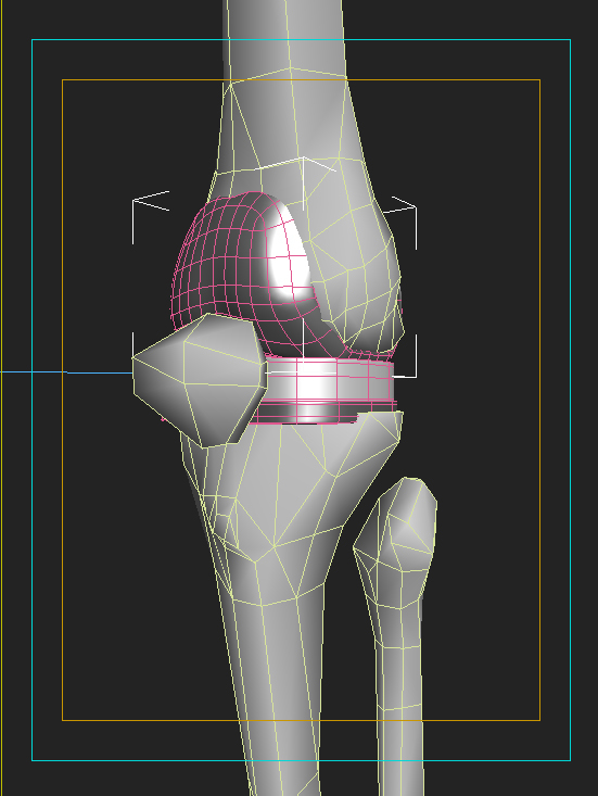 artificial knee replacement 3d model