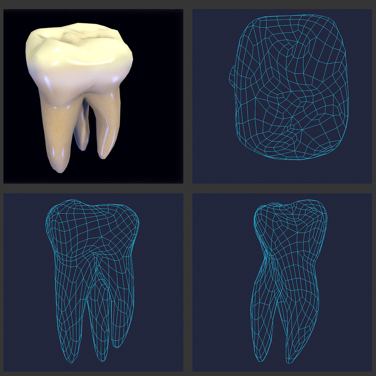 3ds teeth upper molar