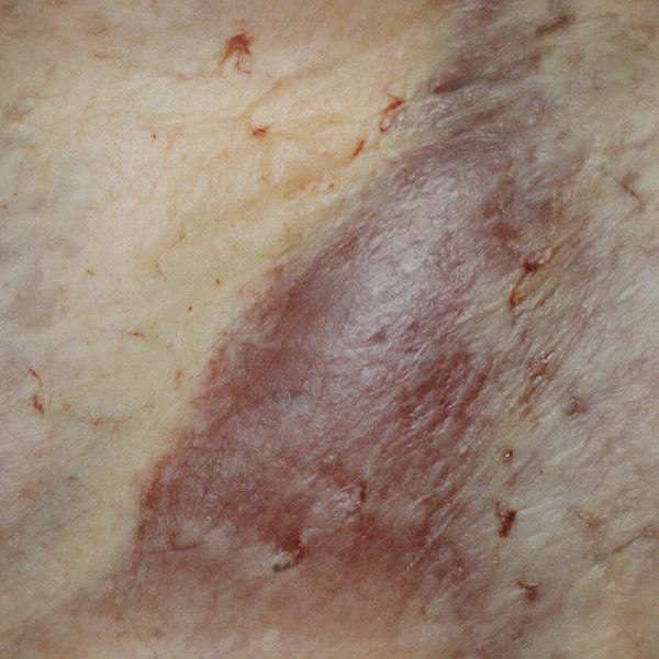 Texture JPEG meat flesh skin