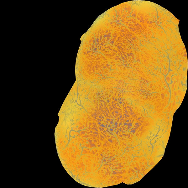 3d fat cell model