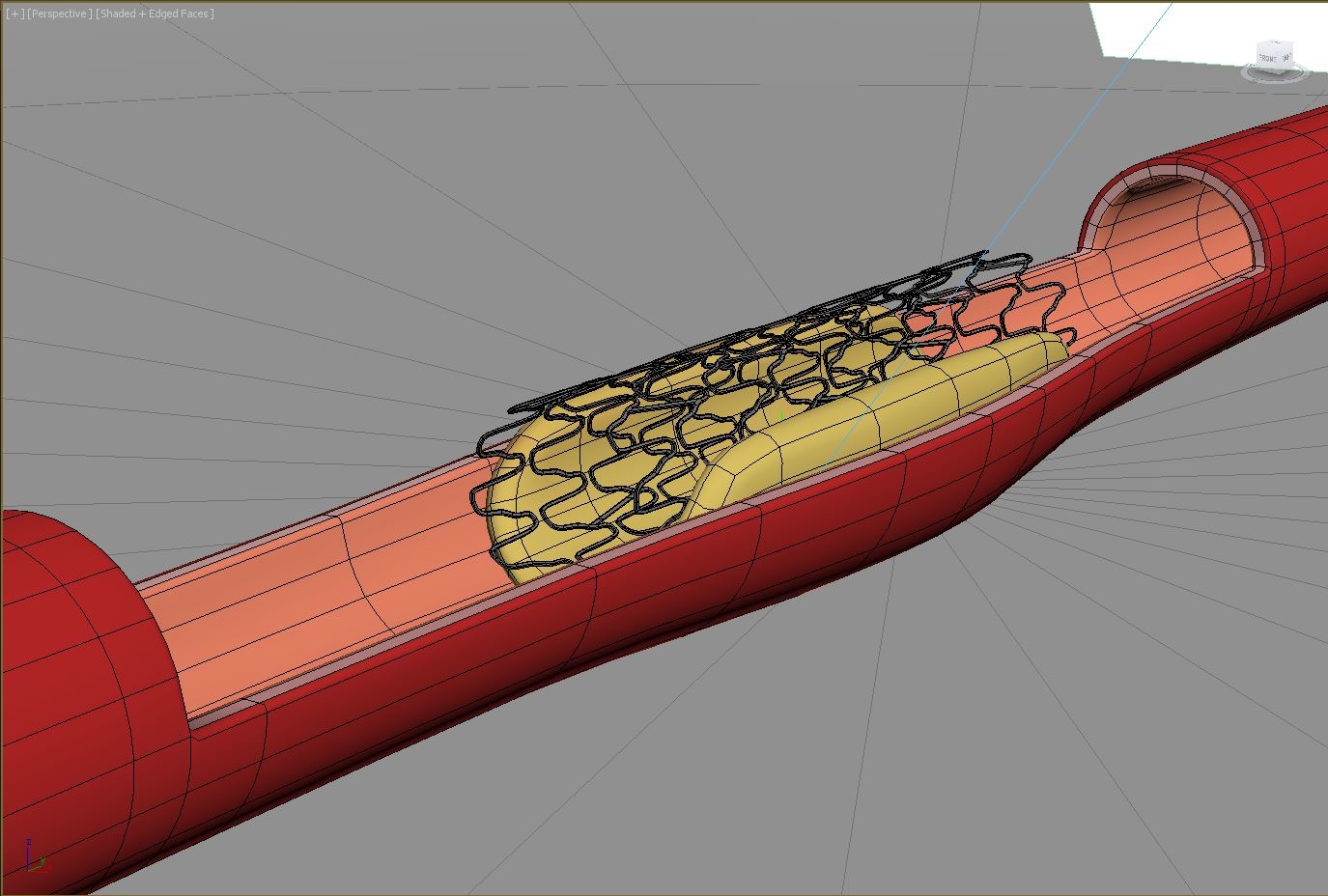 medical cardiovascular stent 3d model