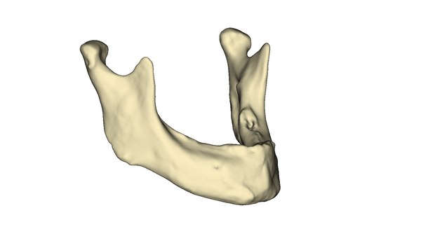 3d mandible model