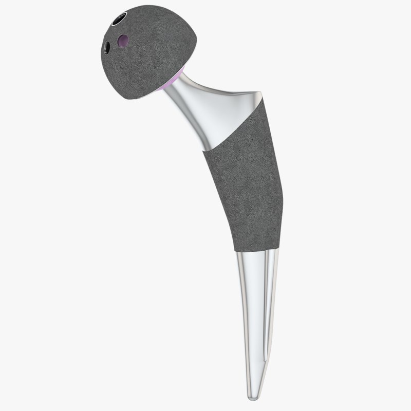 femoral prosthesis obj