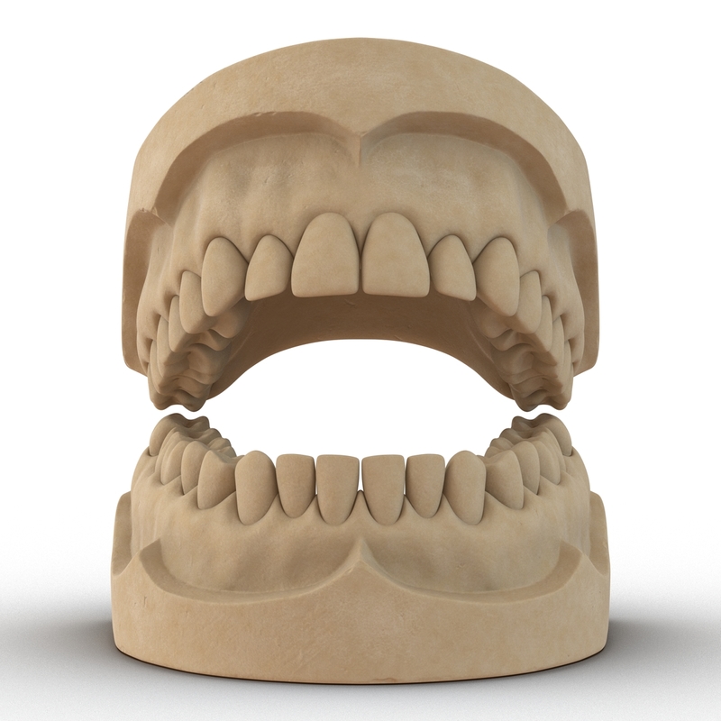 3d dental mold model