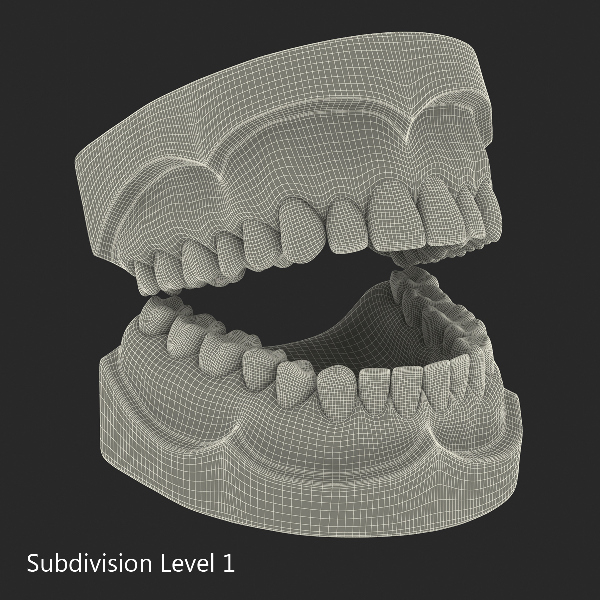 3d dental mold model