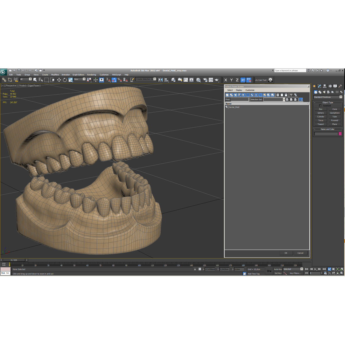 3d dental mold model