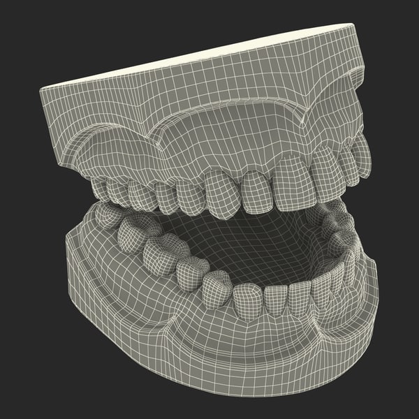 3d dental mold model