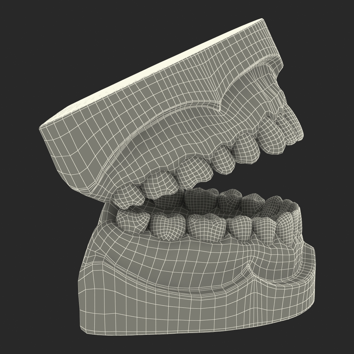 3d dental mold model