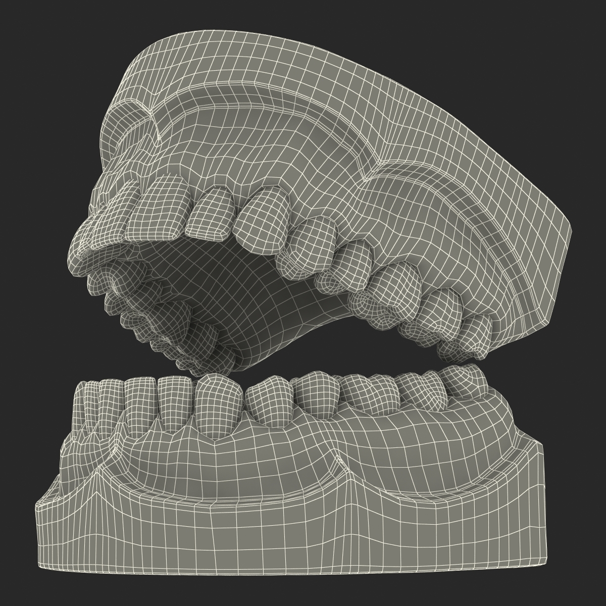 3d dental mold model
