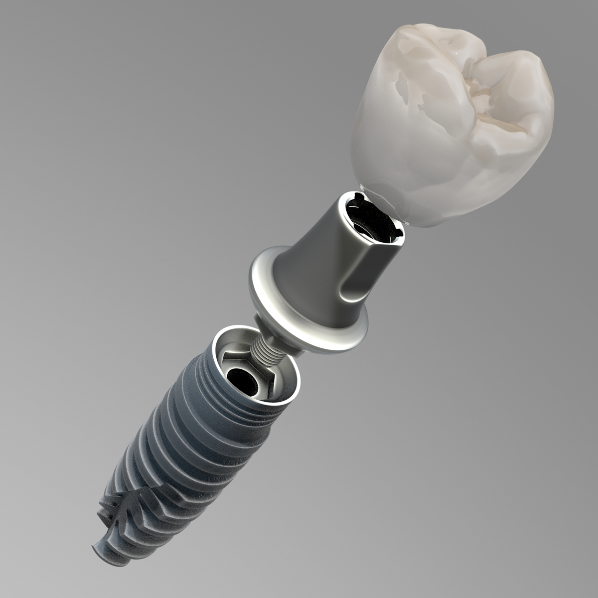 dental implant 3d max