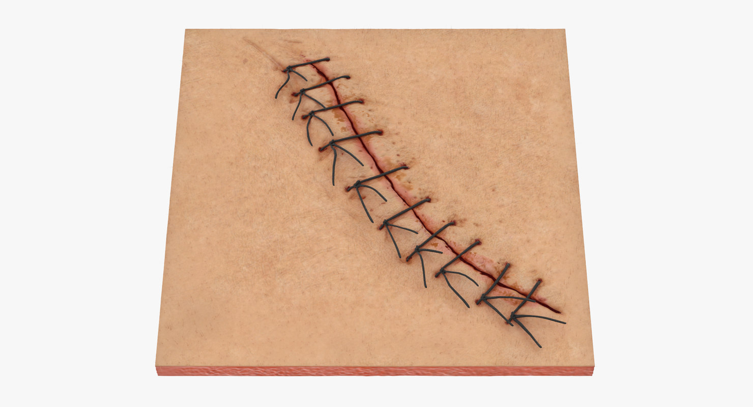 3d sutures