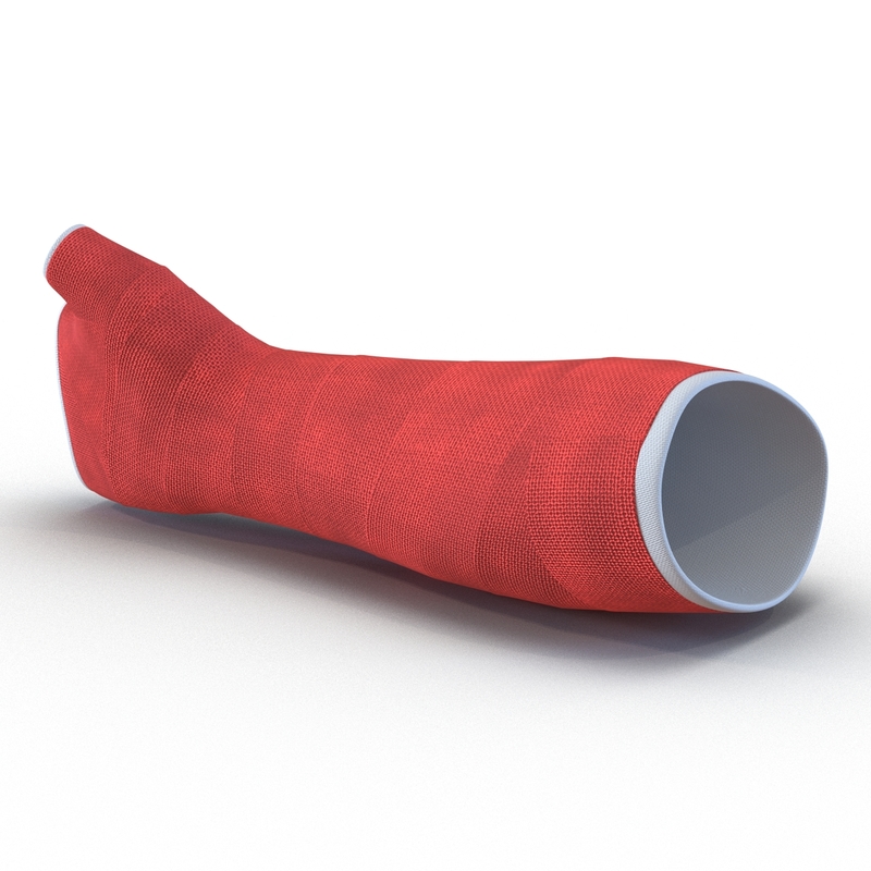 orthopedic cast arm 3d 3ds