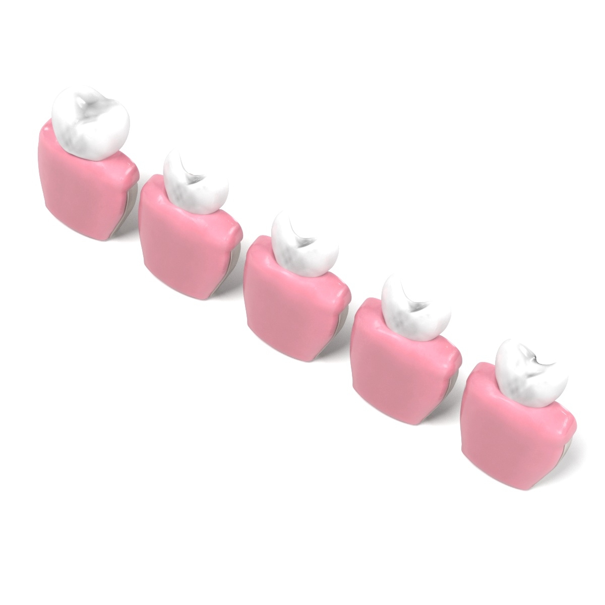3d root canal procedure 3d root canal procedure