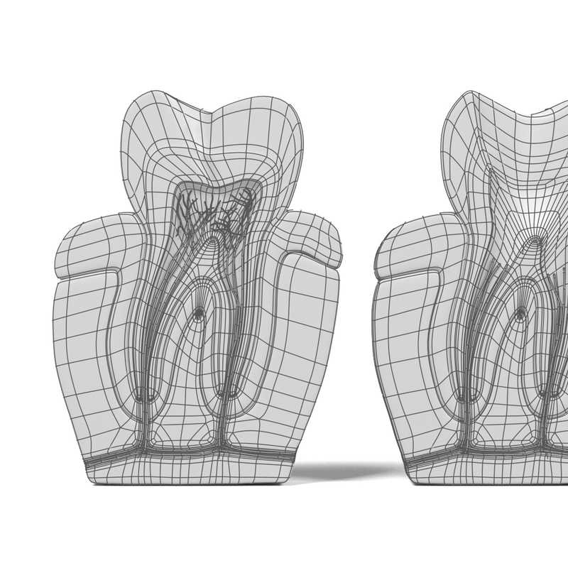 3d root canal procedure