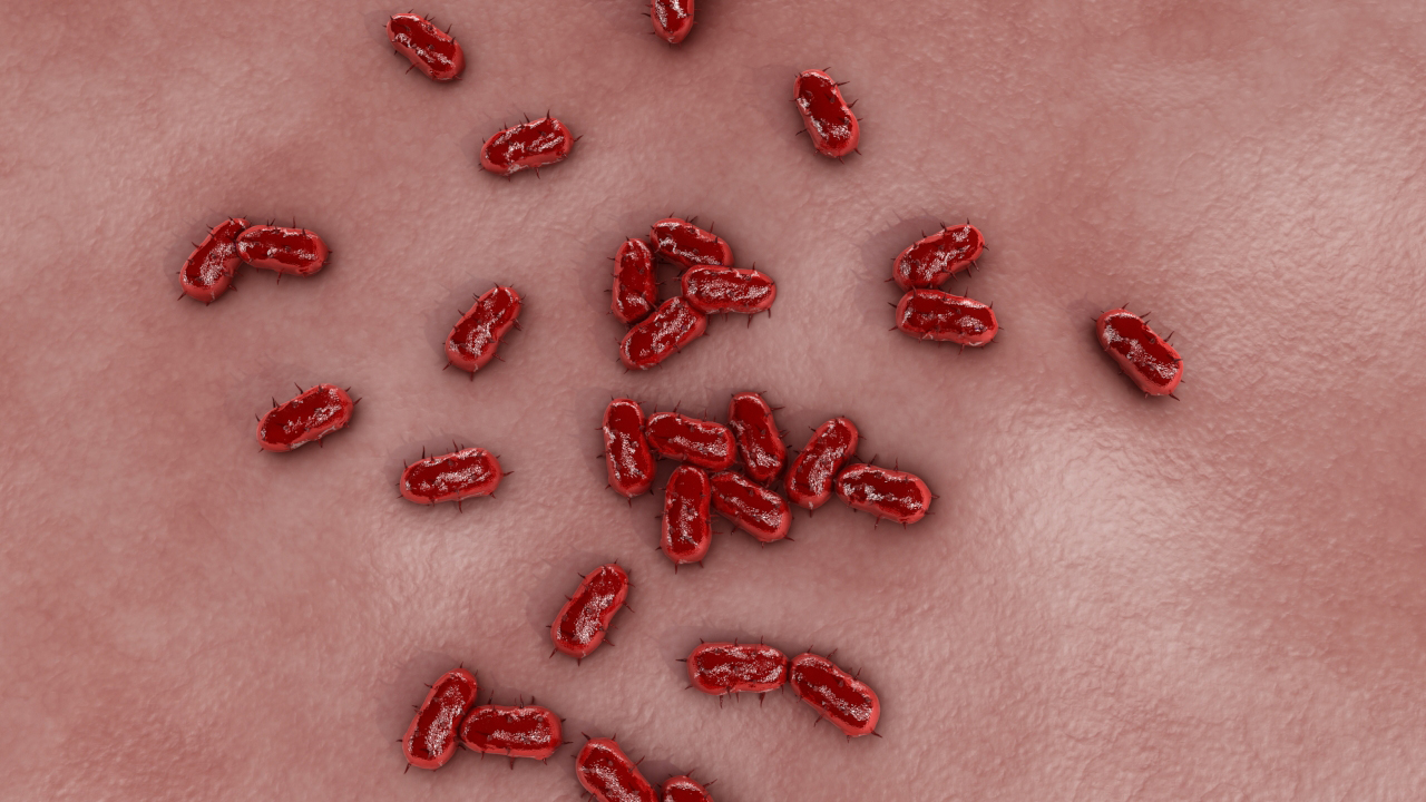 bacterial meningitis 3d model