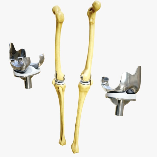 3D hickman catheter model - TurboSquid 1299068
