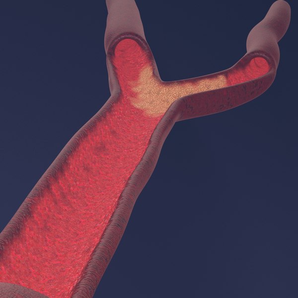3D Artery Models | TurboSquid