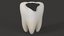 Teeth decay 3D model - TurboSquid 1438129