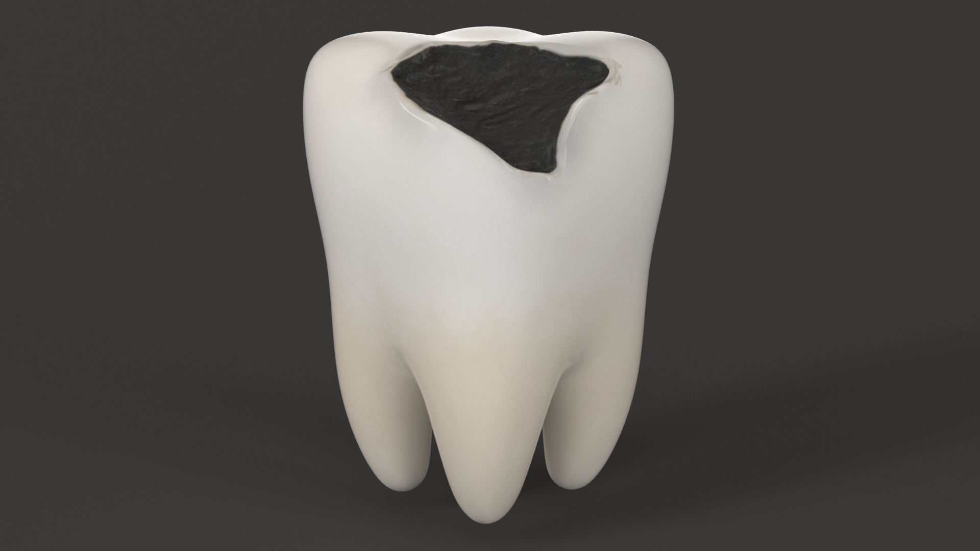 Teeth decay 3D model - TurboSquid 1438129