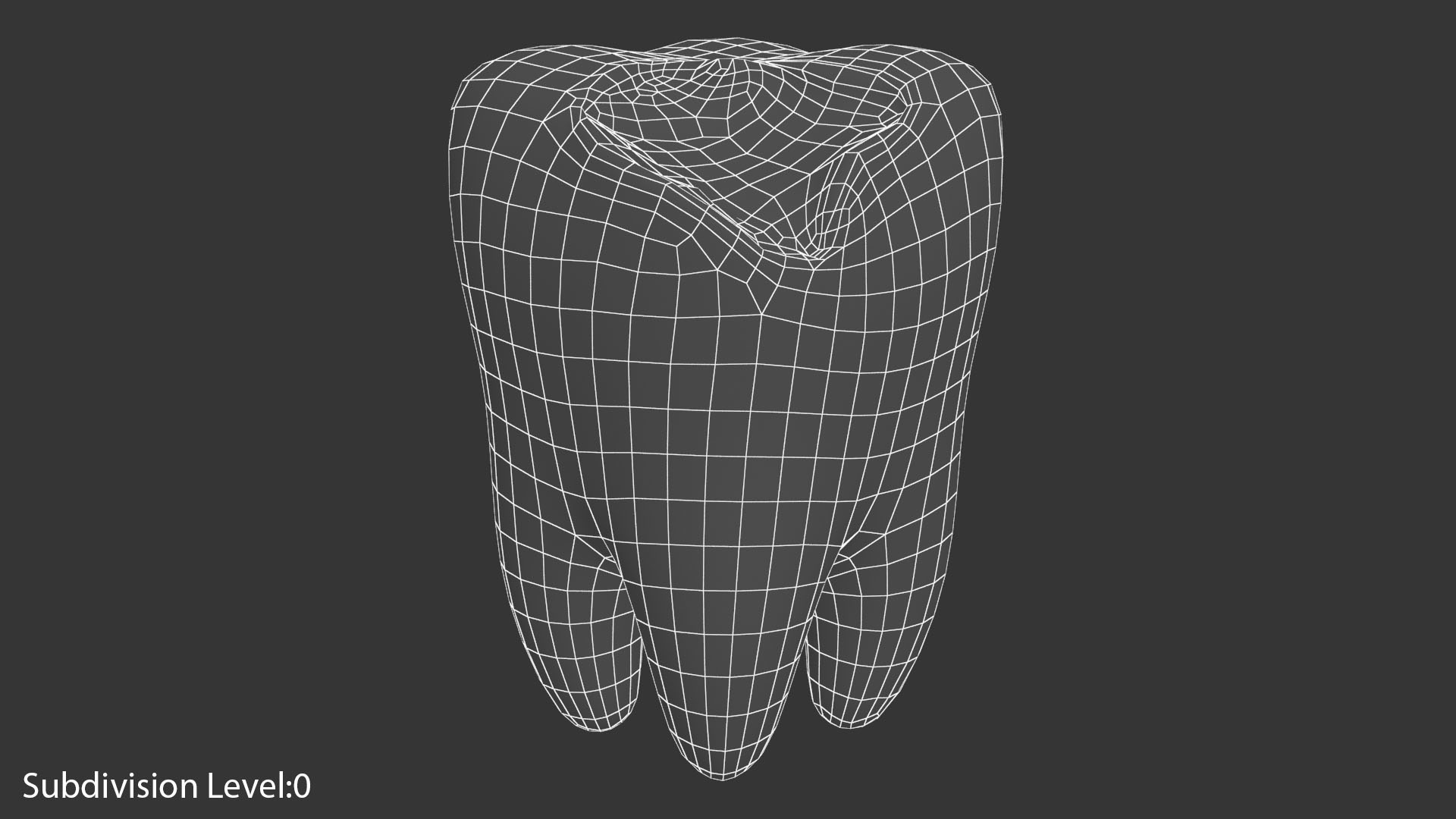 Teeth decay 3D model - TurboSquid 1438129
