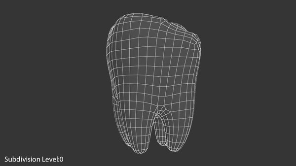 Teeth decay 3D model - TurboSquid 1438129
