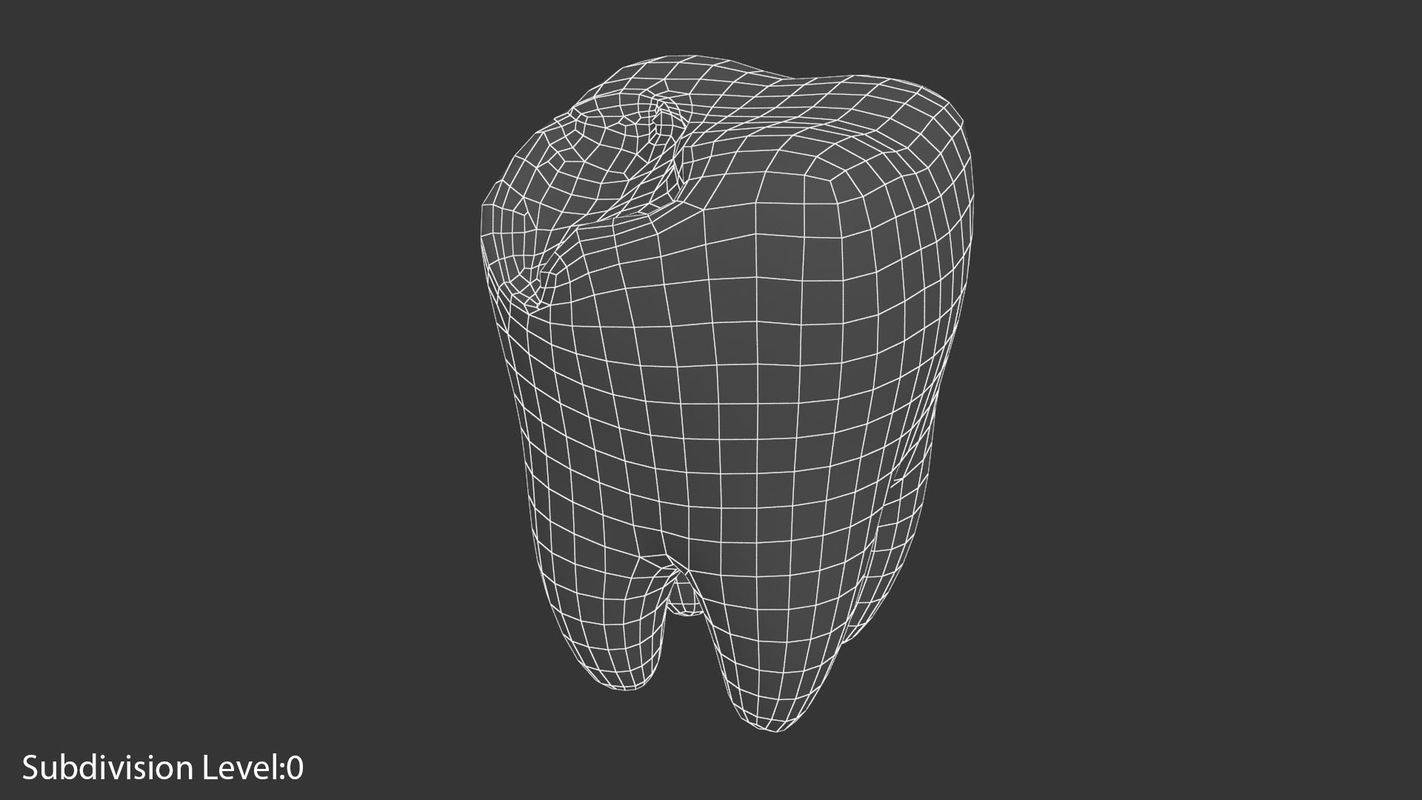Teeth decay 3D model - TurboSquid 1438129