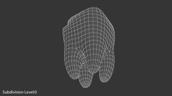 Teeth decay 3D model - TurboSquid 1438129