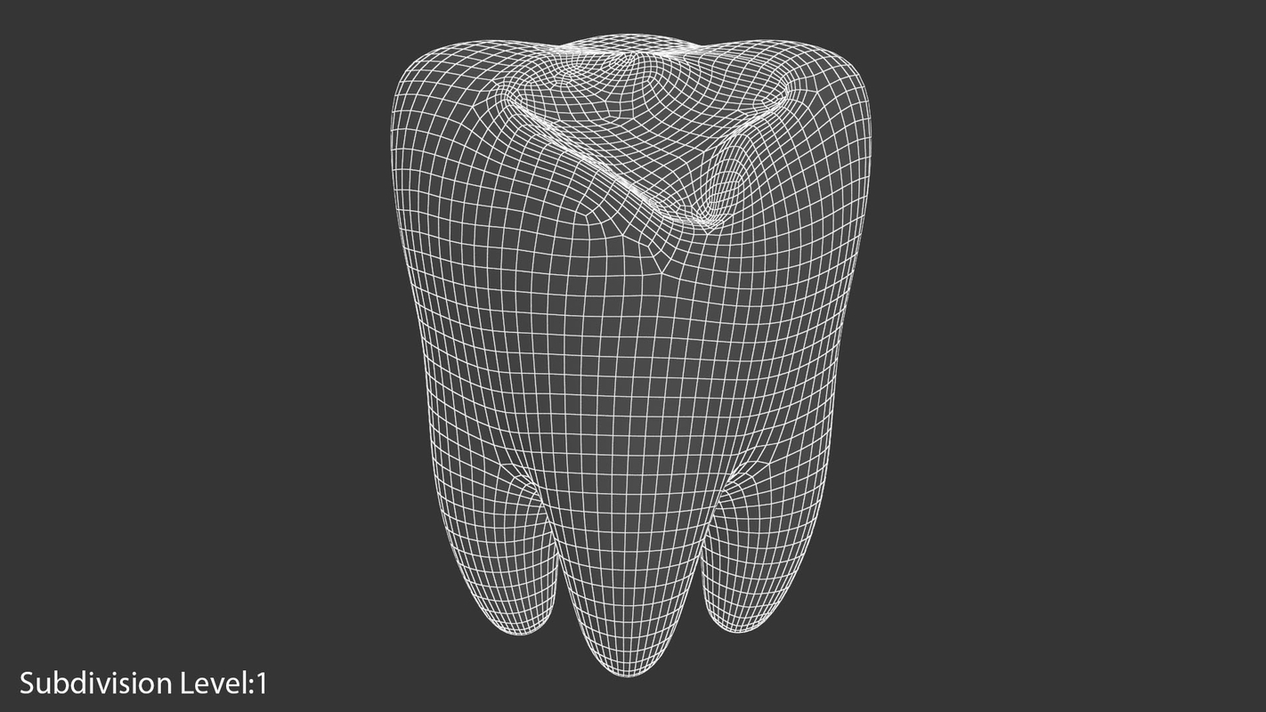Teeth decay 3D model - TurboSquid 1438129