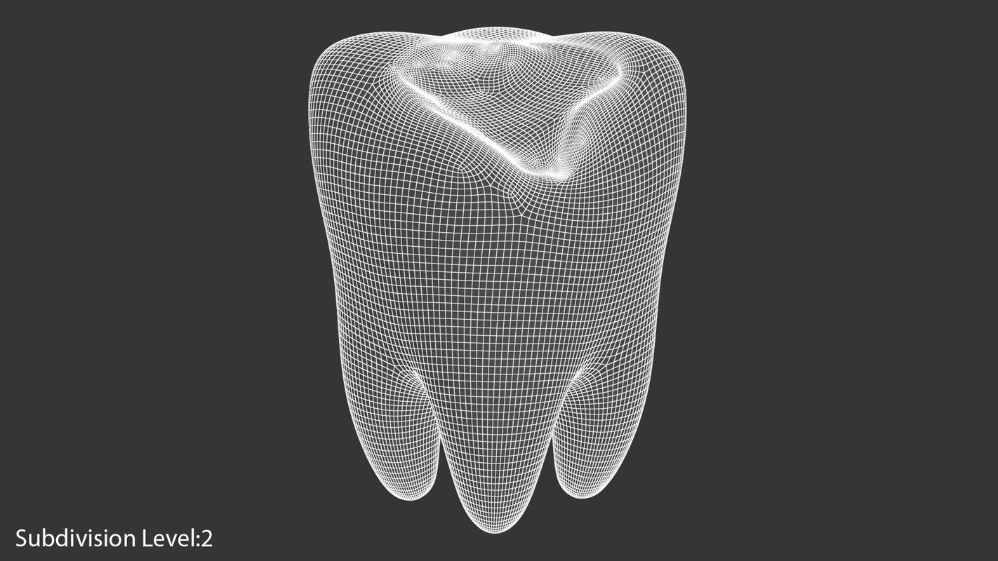 Teeth decay 3D model - TurboSquid 1438129