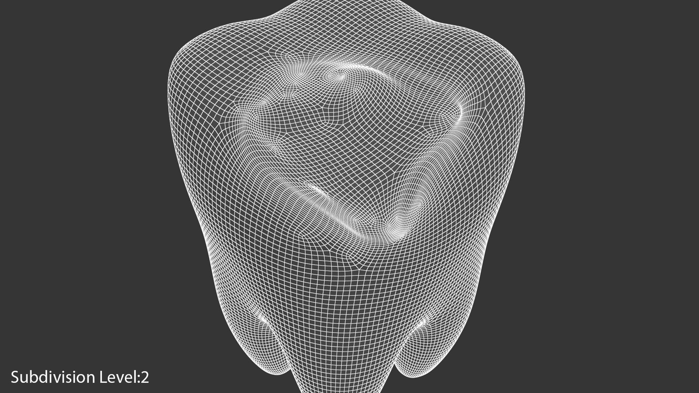 Teeth decay 3D model - TurboSquid 1438129